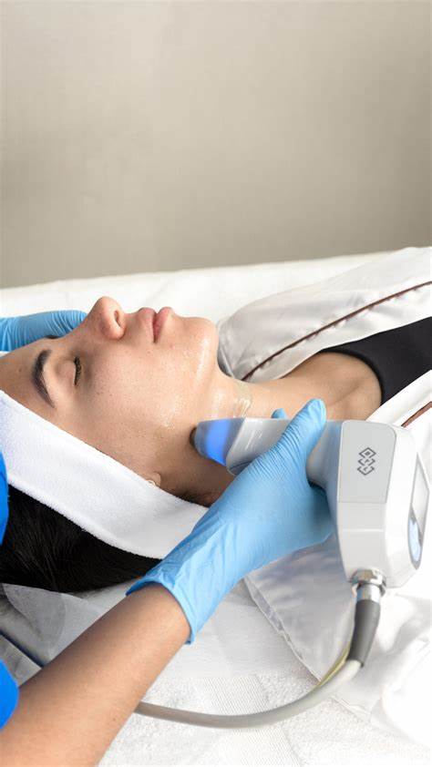 Exilis Ultra Neck Single Session – Elite Aesthetic Clinic